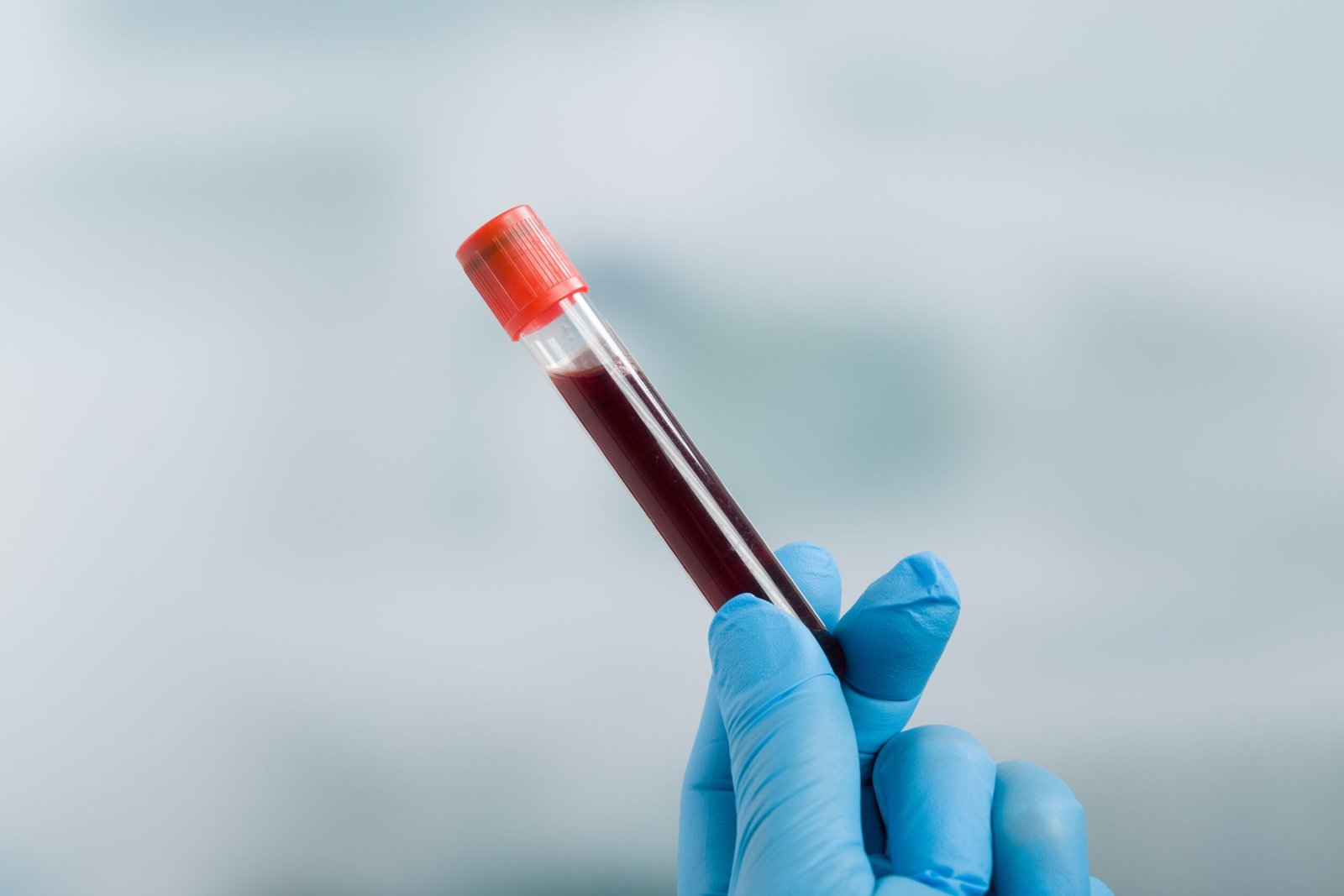 Laboratory Values and Diabetic Ketoacidosis (DKA) - Sentinel Nurse